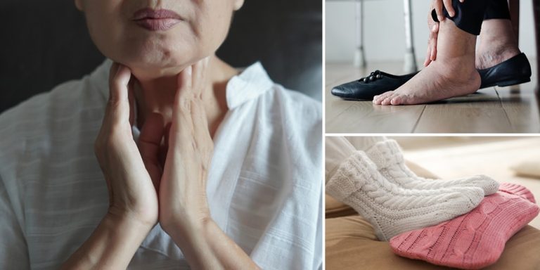 10 Signs Your Feet Are Warning You About a Thyroid Problem - The Lost Herbs