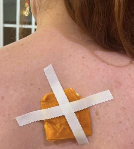 DIY Chili Patches for Quick Pain Relief - The Lost Herbs