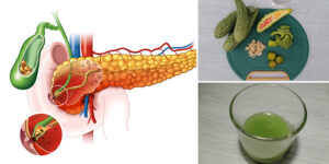 10 Warning Signs Your Pancreas Is In Trouble and When Should You Follow ...